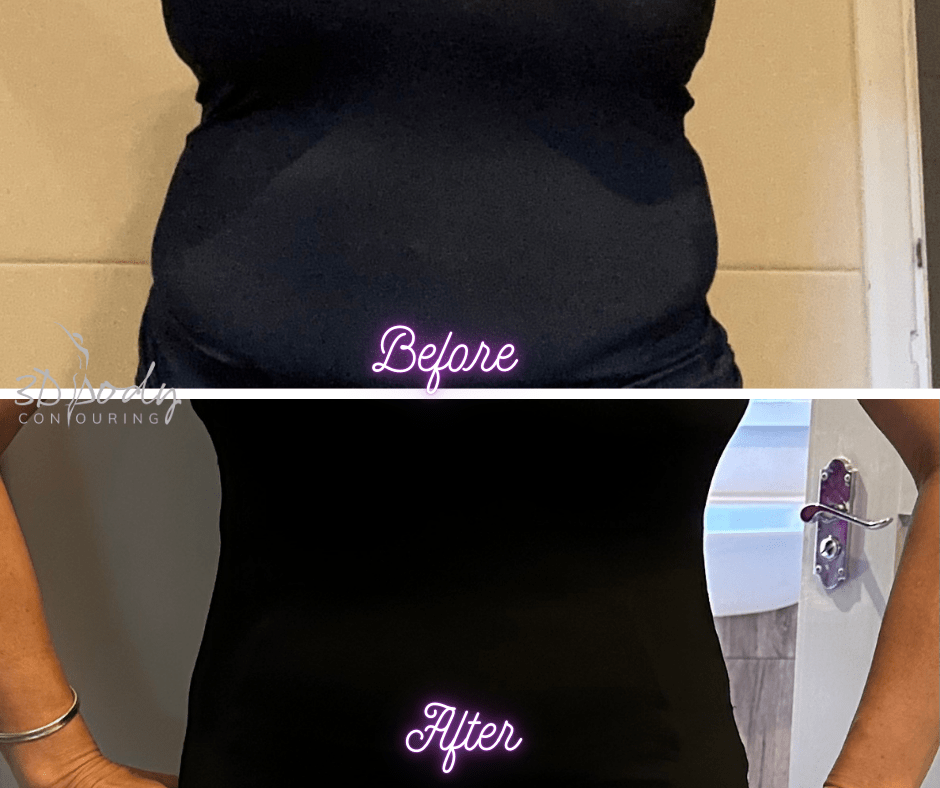 The Hour Glass - 3D Body Contouring